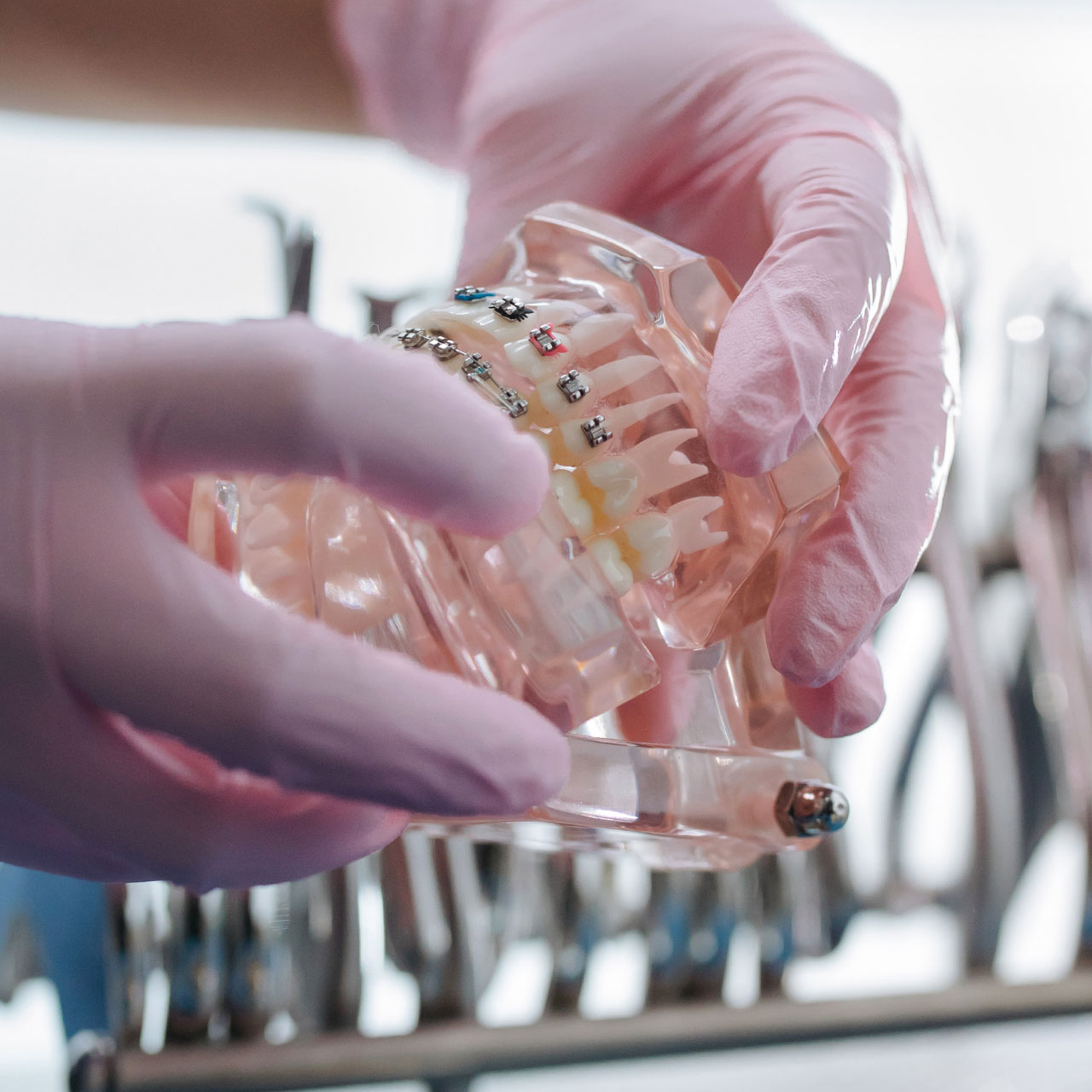 บทความข่าวสาร - คลินิกทันตกรรมวิลเด็นท์ Will Dent Dental Clinic